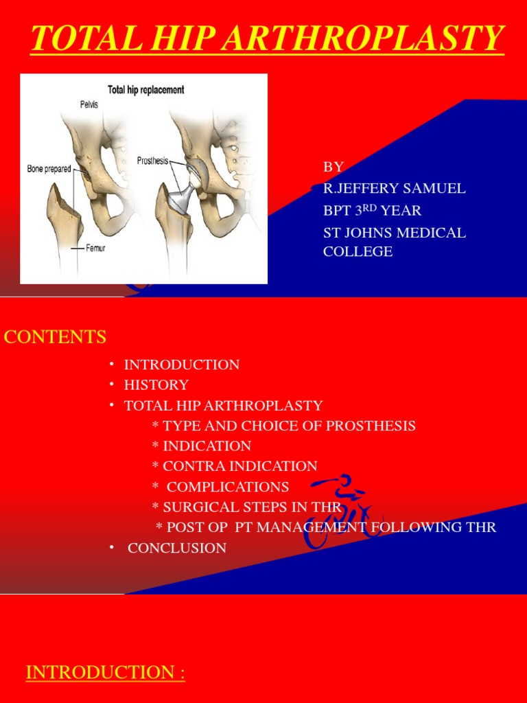 Total Hip Arthroplasty 243 | PDF | Anatomical Terms Of Motion ...