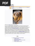 CISTOCLISIS | PDF | Vejiga urinaria | Orina