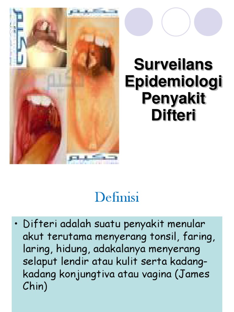 Difteri: Penyebab, Gejala, dan Pencegahan | PDF