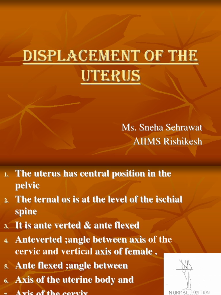Displacement of The Uterus | PDF | Uterus | Childbirth