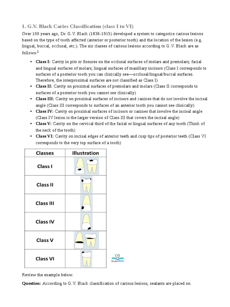G.V. Black Caries Classification (Class I To VI) | PDF | Tooth | Tooth ...