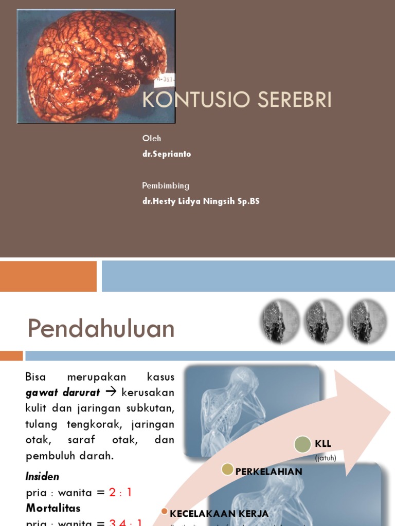 Kontusio Serebri: Epidemiologi dan Penanganan | PDF