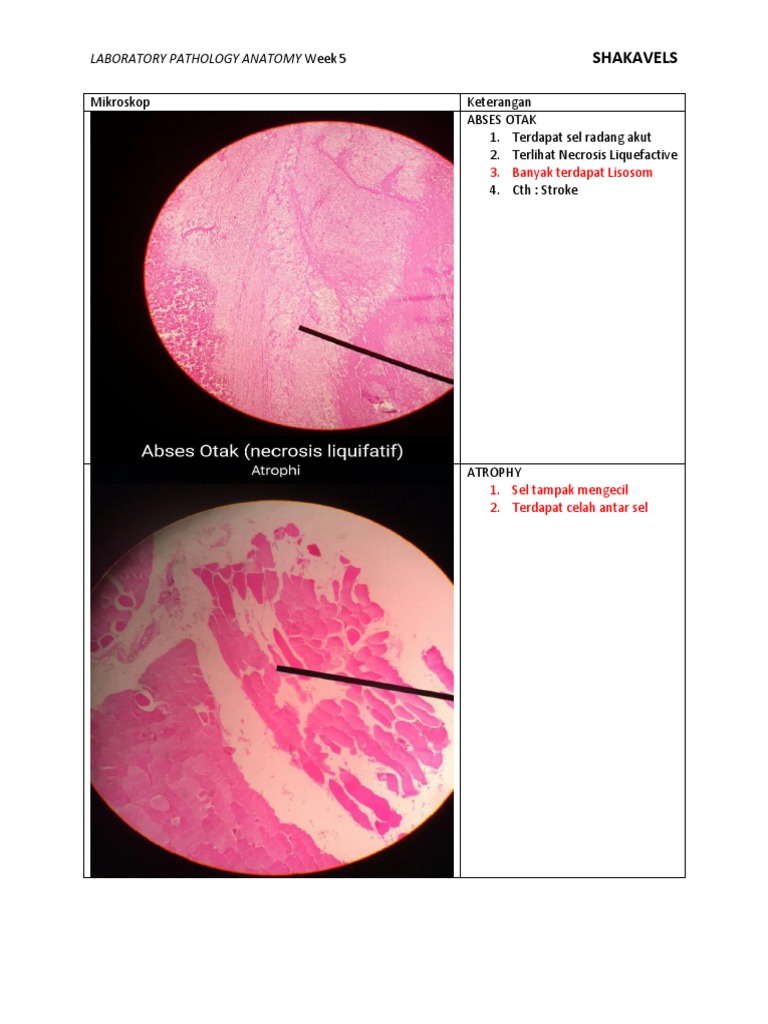 Pathology Anatomy | PDF