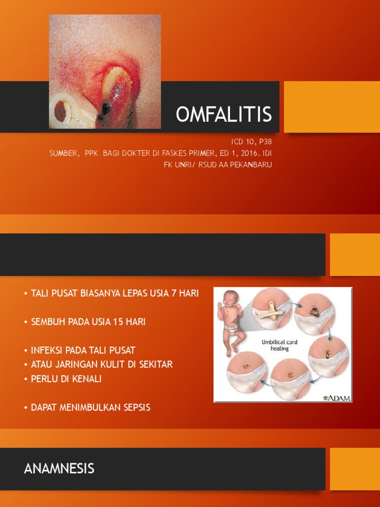 OMFALITIS | PDF | Kesehatan Holistik