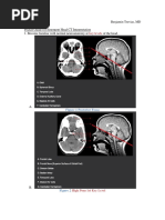 Interpreting CT Brain Scans | PDF | Ct Scan | Clinical Medicine