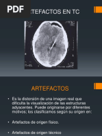 Pitch y TC Helicoidal | PDF | Ct Scan