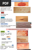 LESIONES DERMATOLOGICAS PRIMARIAS Correcto | PDF | Piel | Sistema ...