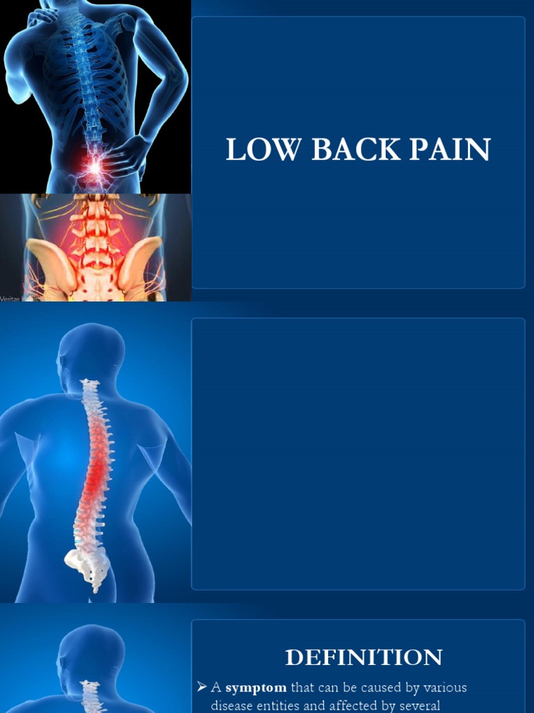 Understanding Low Back Pain: Causes & Types | PDF | Vertebra ...