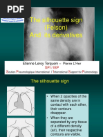 Hilum Overlay Sign in Chest Imaging | PDF