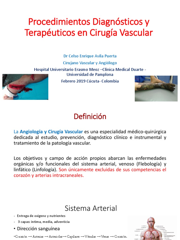 Procedimientos Diagnosticos y Terapeuticos CX Vascular ENVIAR | PDF | Stent | Sistema linfático