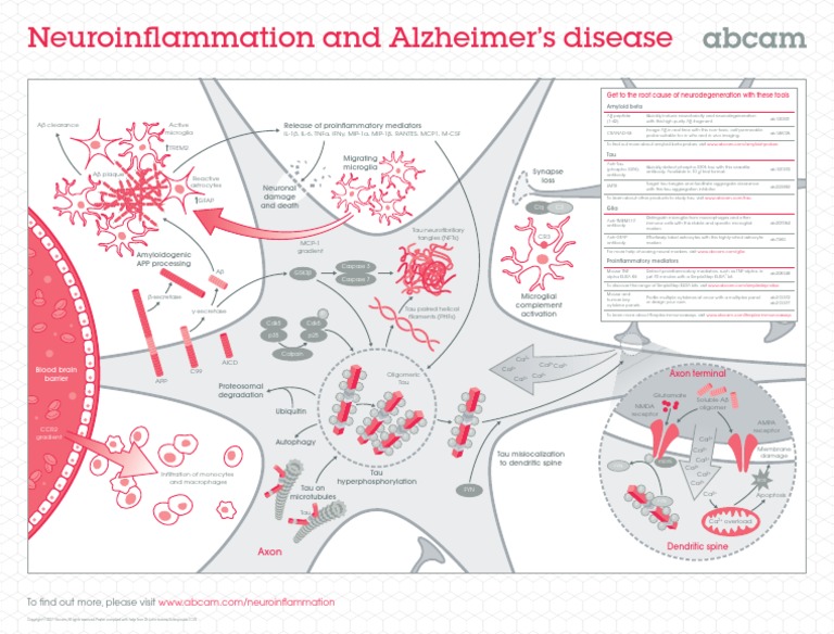 Neuroinflammation and Alzheimers Disease Poster | PDF | Amyloid Beta ...