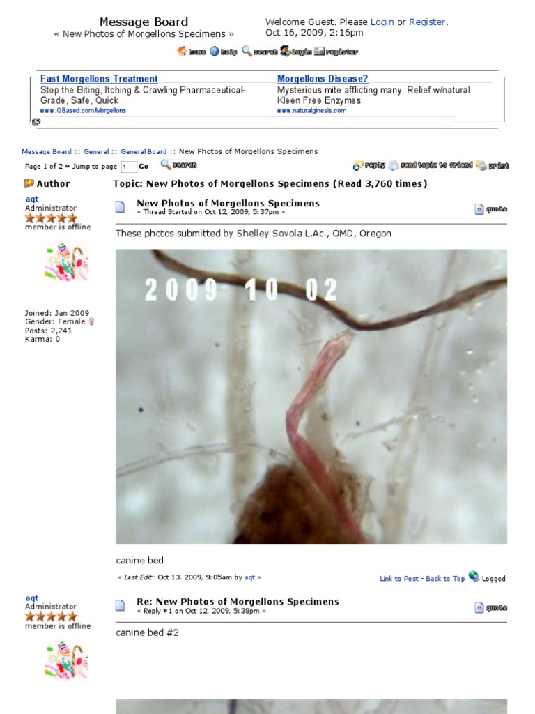 New Morgellons Specimens Photos | PDF | Internet Forum