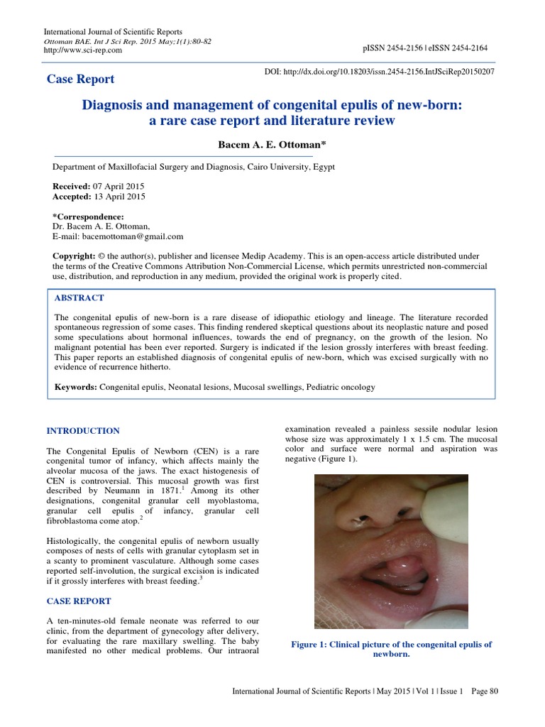 Diagnosis and Management of Congenital Epulis of New-Born: A Rare Case ...
