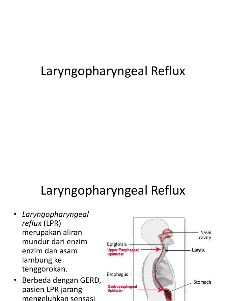 Laryngopharyngeal Reflux: Gejala dan Tatalaksana | PDF