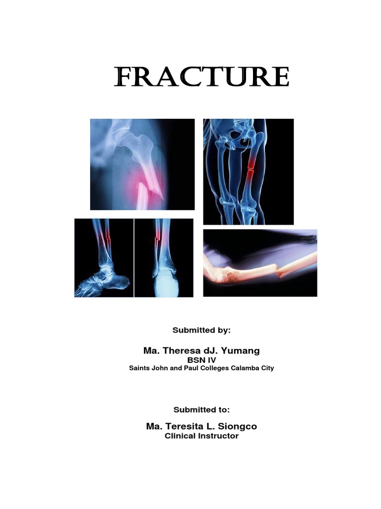 Bone Fracture | PDF | Bone | Ct Scan