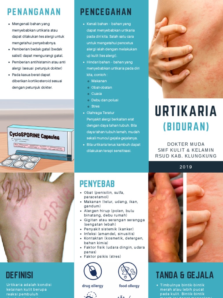 Pamflet Urtikaria PDF | PDF