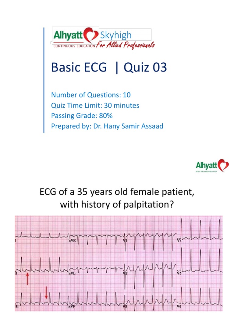 ECG Quiz: Diagnose Heart Conditions | PDF