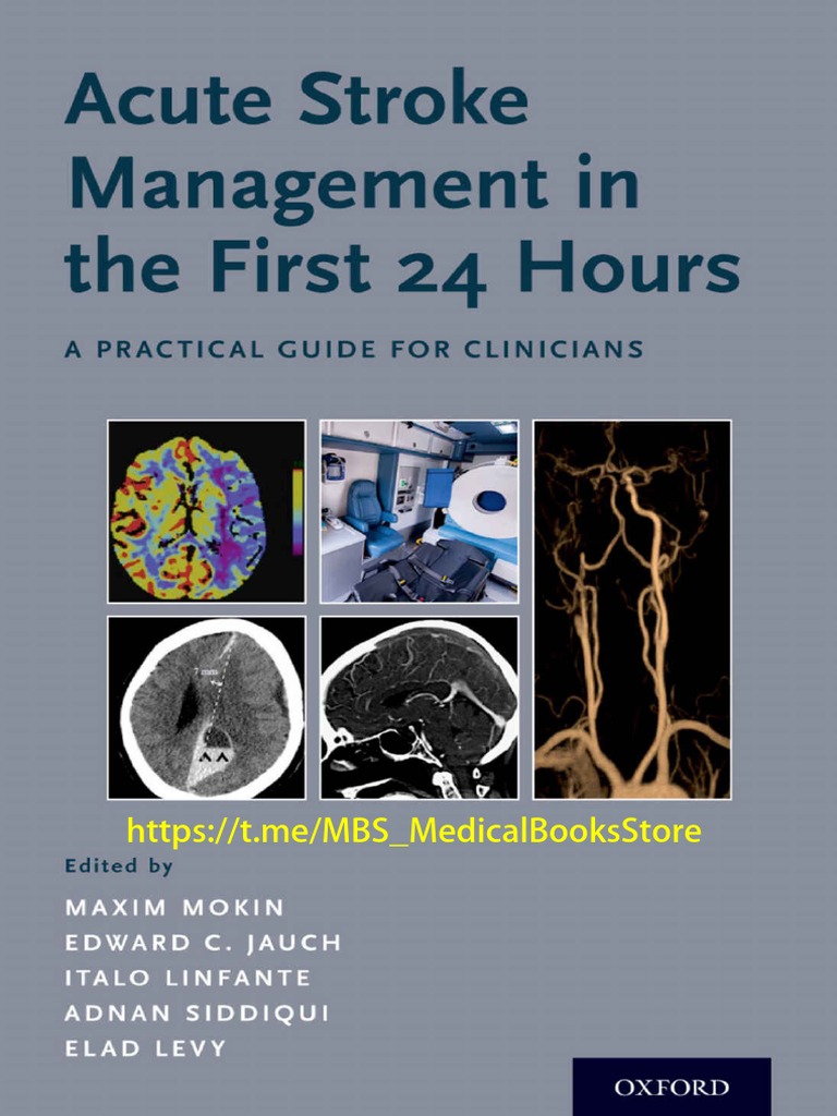 Manajemen Stroke | PDF | Stroke | Cerebral Cortex