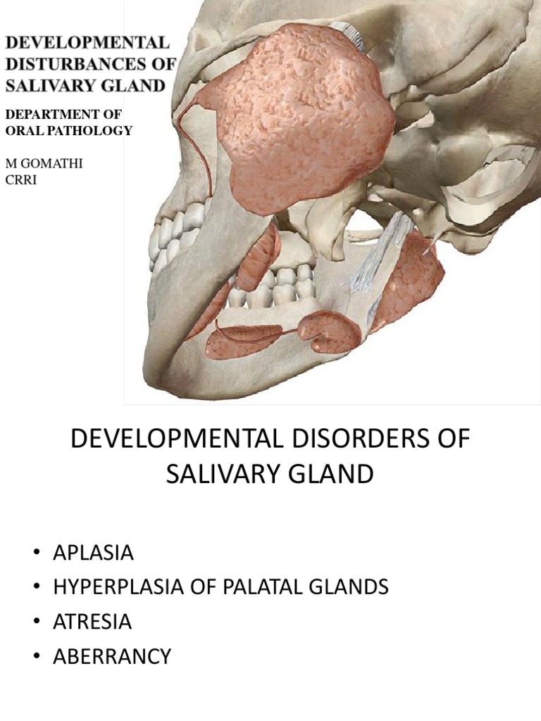Developmental Disturbances of Salivary Glands | PDF | Medical ...