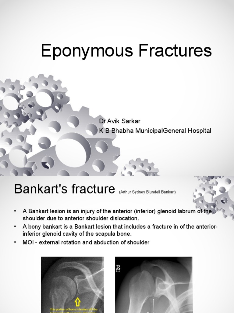 Eponymous Fractures Overview | PDF | Vertebra | Ankle