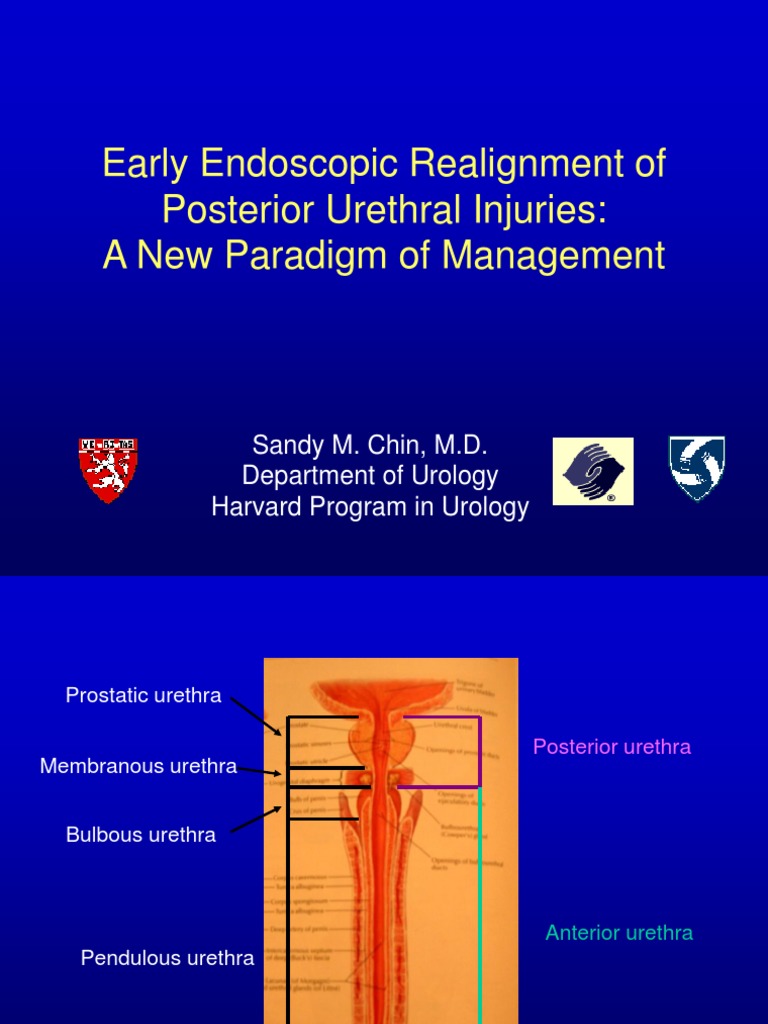 Early Endoscopic Realignment of Posterior Urethral Injuries: A New ...