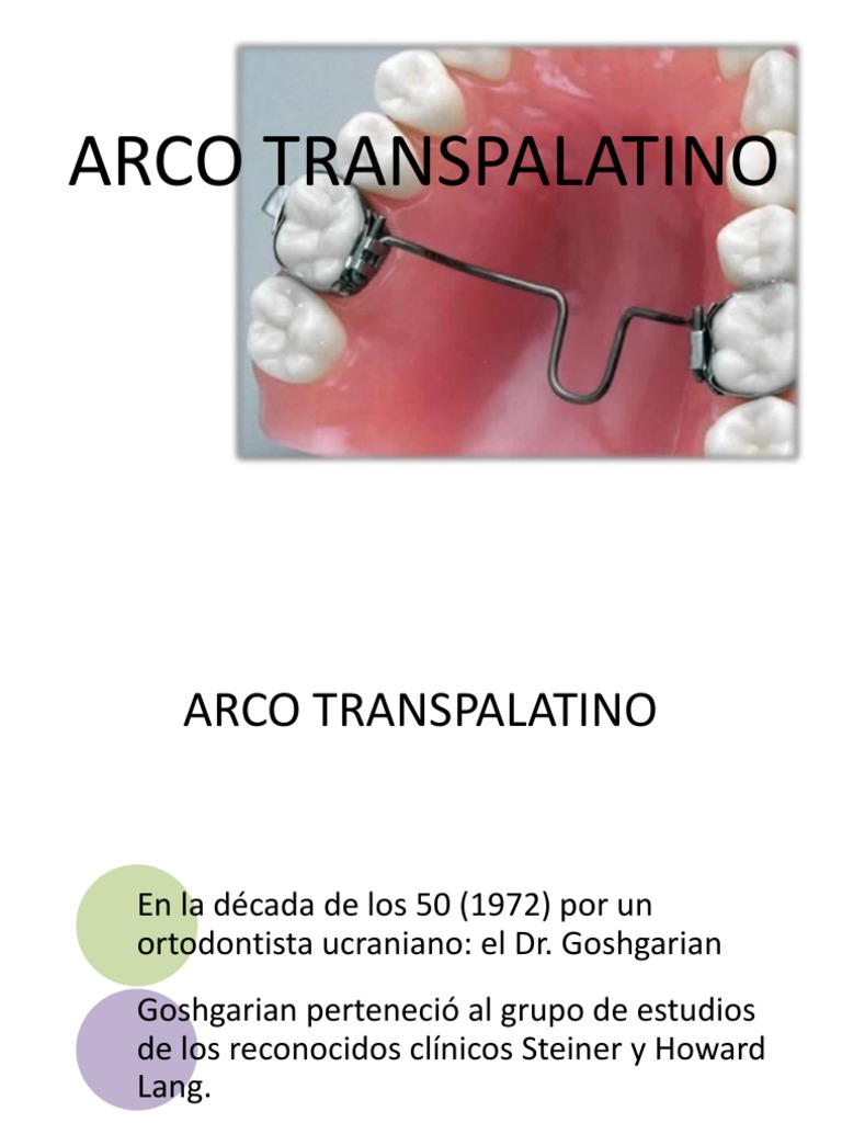 Arco Transpalatino | Ortodoncia | Diente