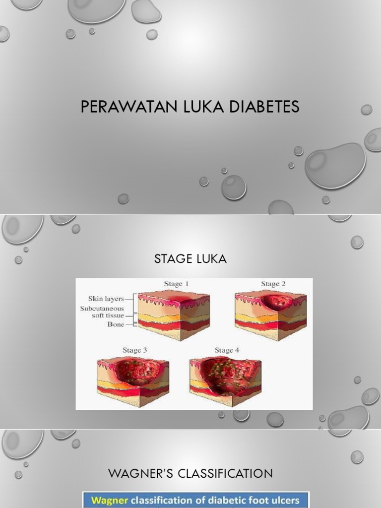 Klasifikasi Luka Wagner pada Diabetes | PDF