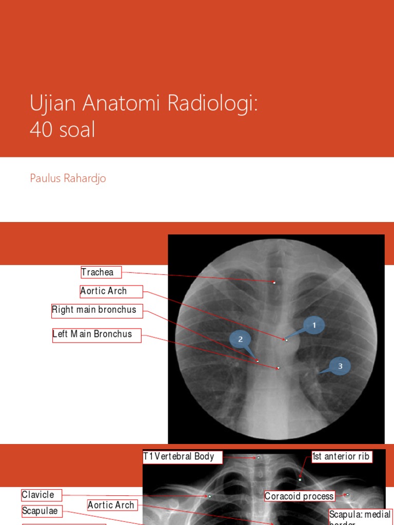 Ujian Anatomi Radiologi Rev | PDF | Vertebra | Aorta