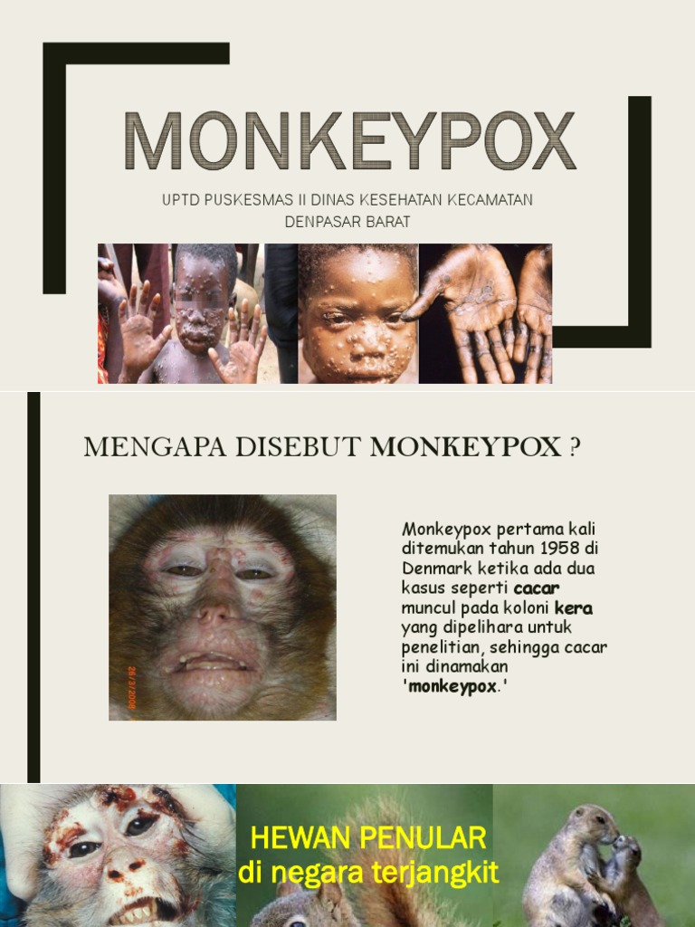 Monkeypox | PDF
