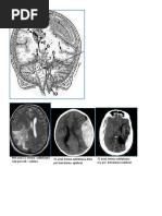 Deterioro Rostrocaudal: Etiología | PDF | Medicina | Sistema nervioso