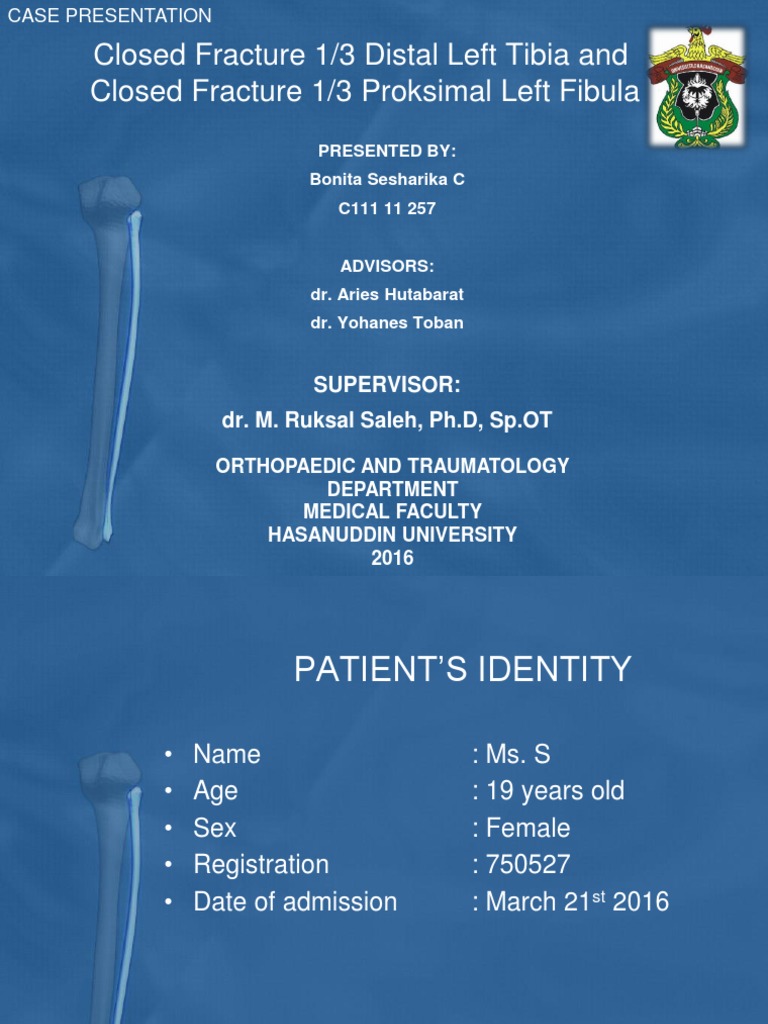 Closed Fracture 1/3 Distal Left Tibia and Closed Fracture 1/3 Proksimal Left Fibula | PDF ...