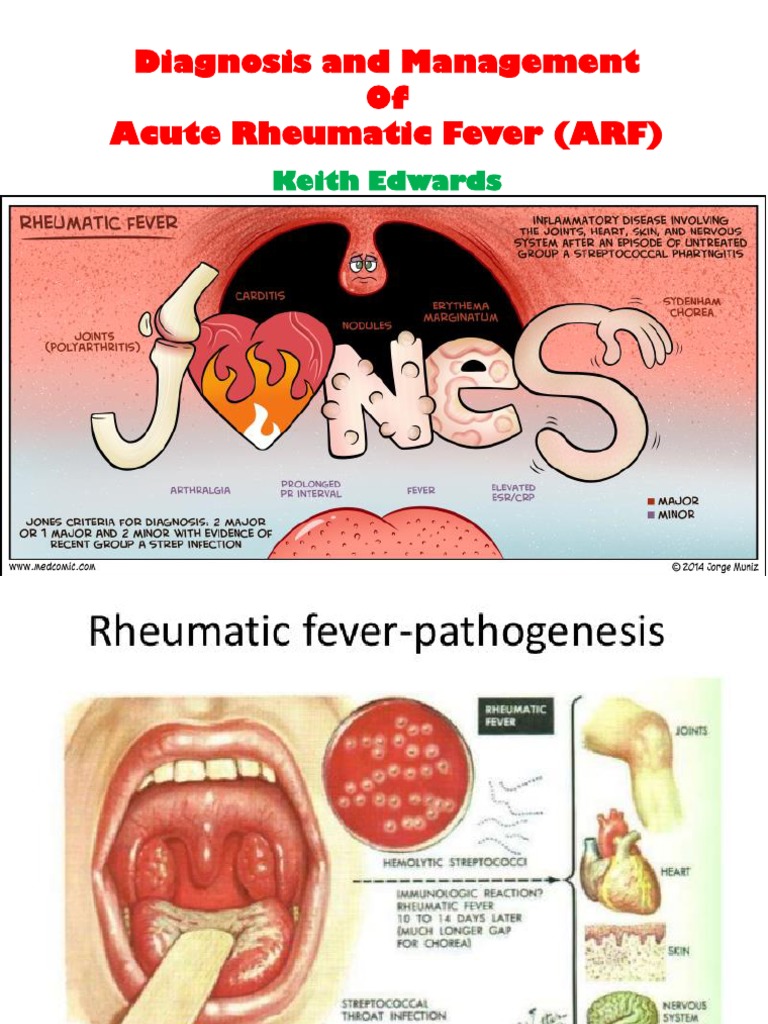 Acute Rheumatic Fever: Diagnosis & Management | PDF | Medical Diagnosis ...