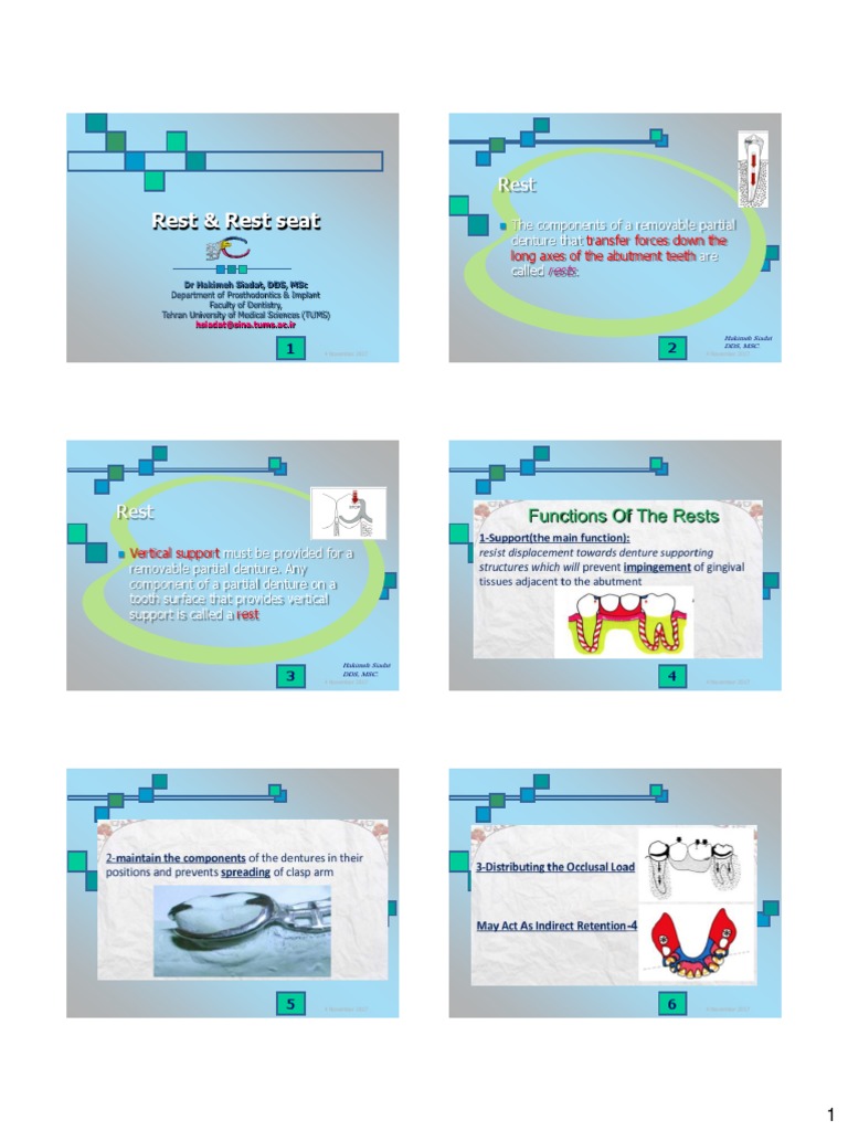 Rests and Rest Seats: Key Components of Removable Partial Dentures ...