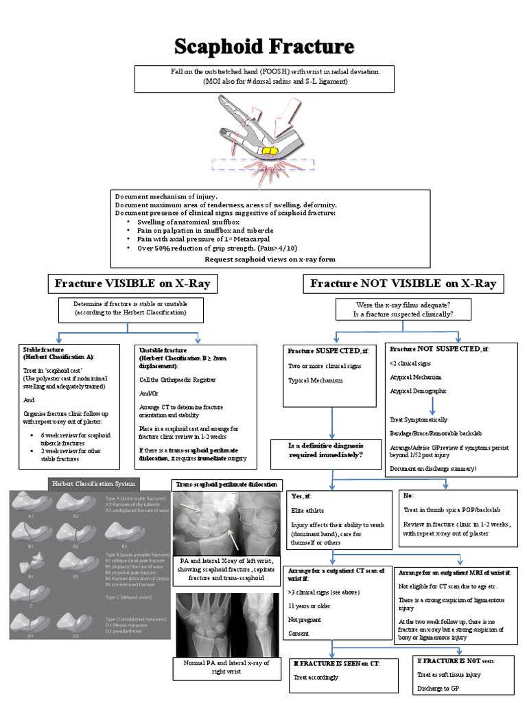 Scaphoid Pathway A3 Version 4 | PDF | Injury | Biomechanics