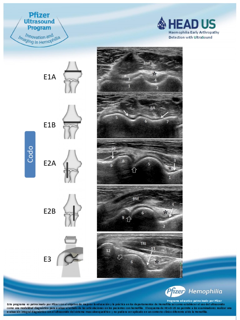 HEAD-US Protocolo de Ultrasonido | PDF | Rodilla | Codo