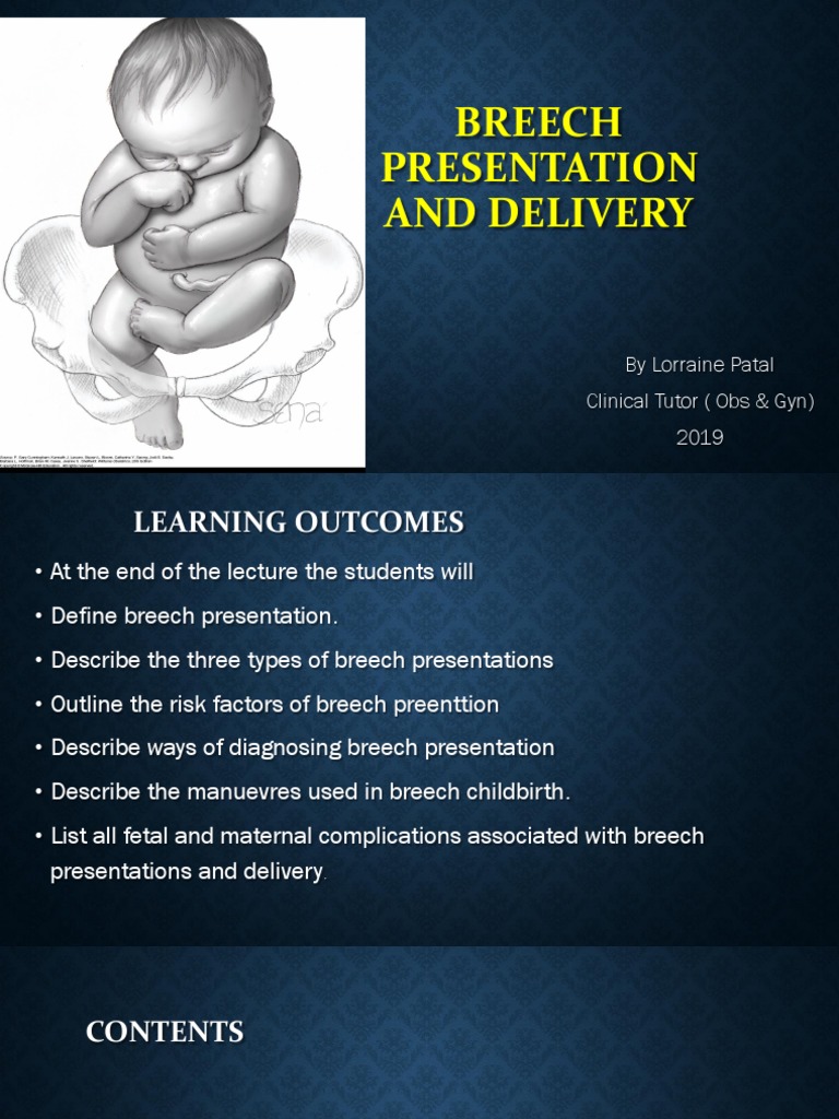 Managing Breech Presentations: A Comprehensive Guide to Diagnosis ...