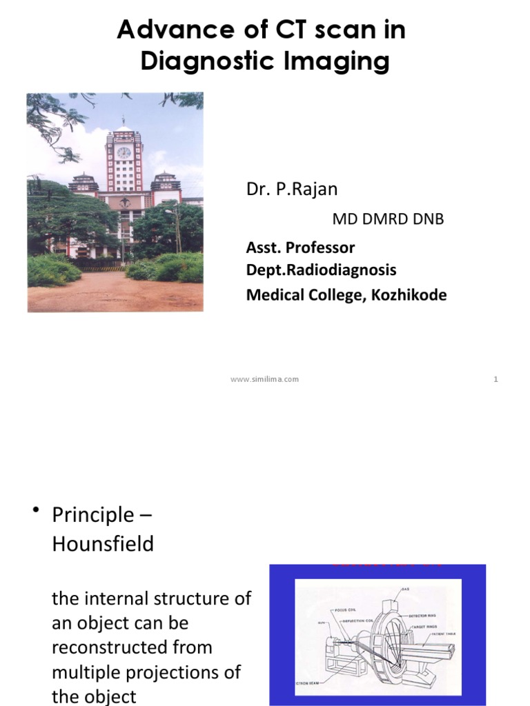 Advanced CT Scan | PDF | Traumatic Brain Injury | Neurological Disorders