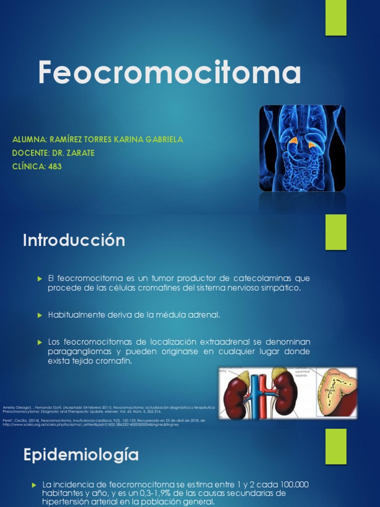 Feocromocitoma | PDF | Hipertensión | Especialidades Medicas