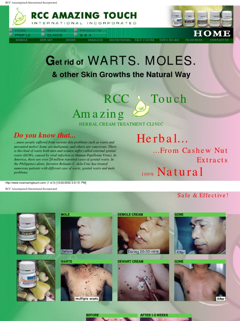 RCC Amazing Touch | PDF | Scar | Surgery