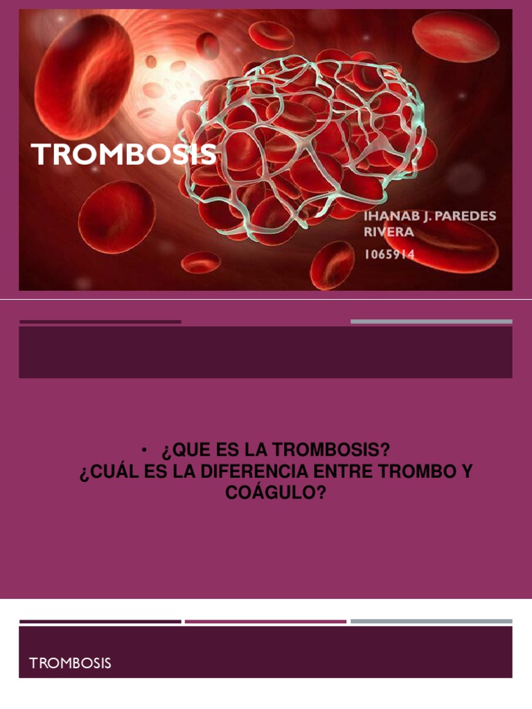 Trombosis | PDF | Trombo | Plaqueta