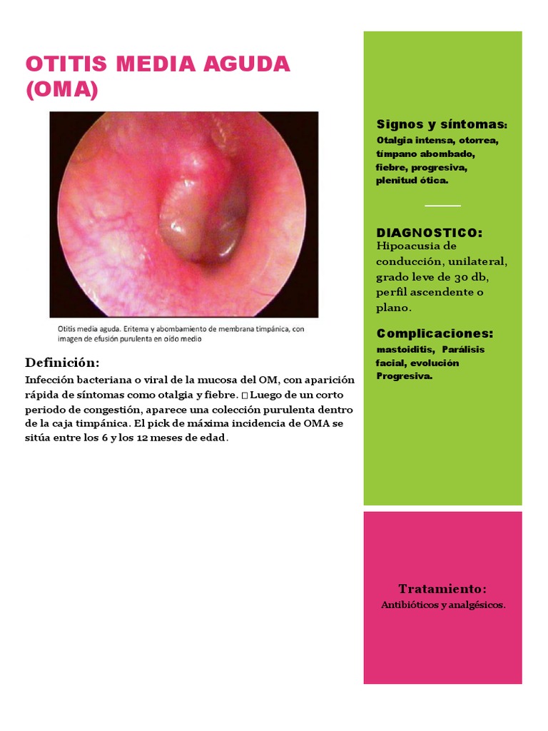 Otitis Media Aguda y Crónica | PDF | Audiología | Escuchando