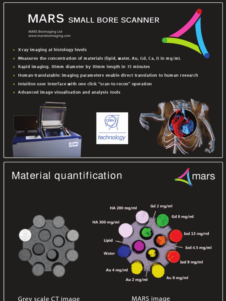MARS Small Bore Scanner PDF | PDF | Medical Imaging | Ct Scan