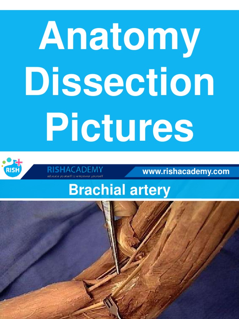 Upper Limb Dissection Overview | PDF | Limbs (Anatomy) | Human Anatomy