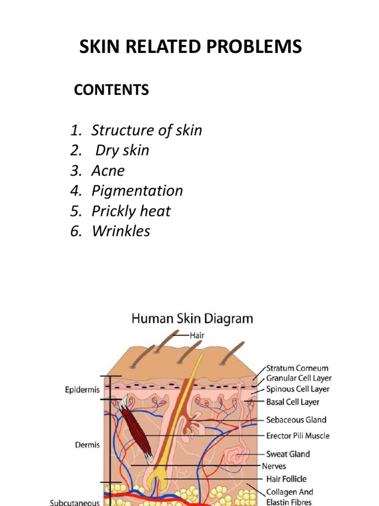 Skin Related Problems: 1. Structure of Skin 2. Dry Skin 3. Acne 4 ...
