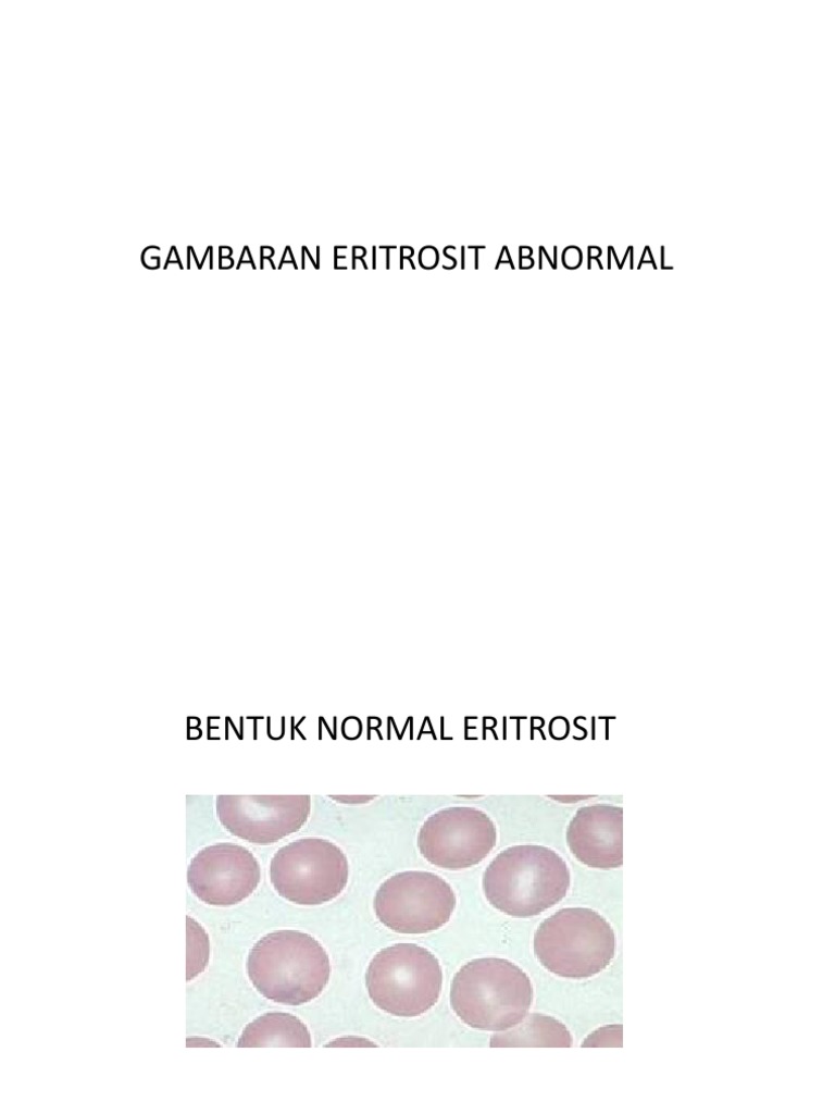 Kelainan Morfologi Eritrosit | PDF