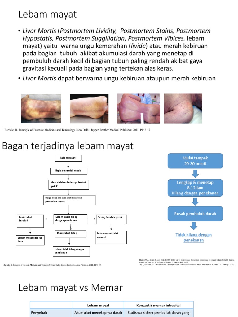 Revisi Lebam Mayat | PDF