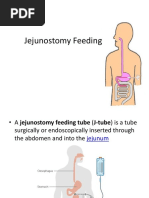 Gastrostomy Tube Feeding Procedure | PDF | Medical Specialties | Medicine