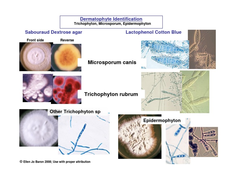 Dermatophyte Identification Methods | PDF