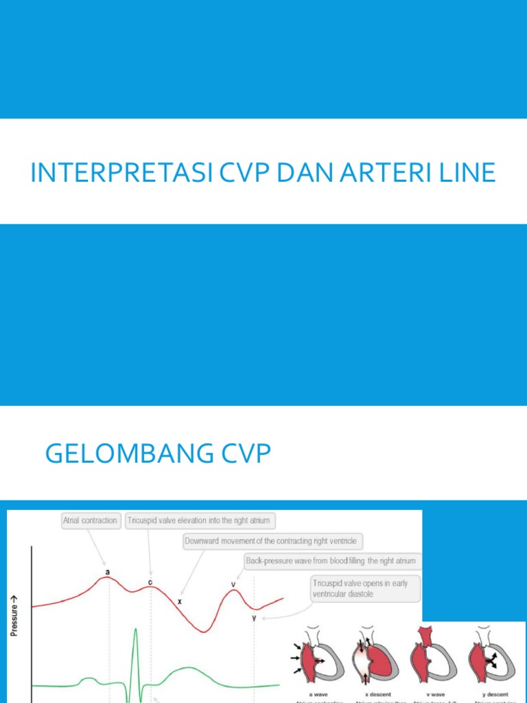 Interpretasi Gelombang CVP dan Arteri | PDF