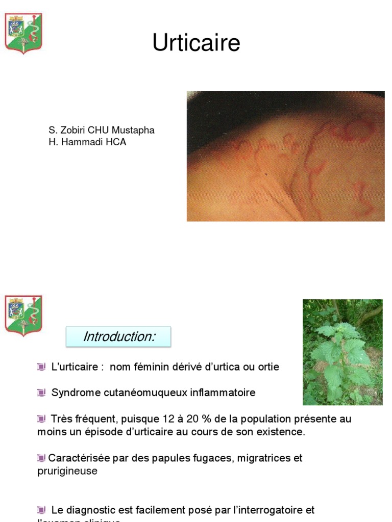 Comprendre l'Urticaire et ses Causes | PDF | Maladies et troubles ...